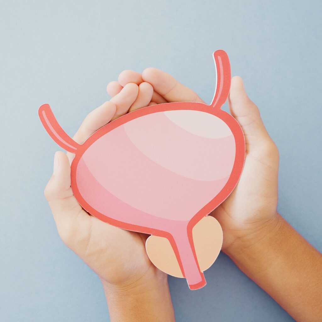 Experts Discuss Radical Cystectomy as Treatment for Bladder Cancer ...