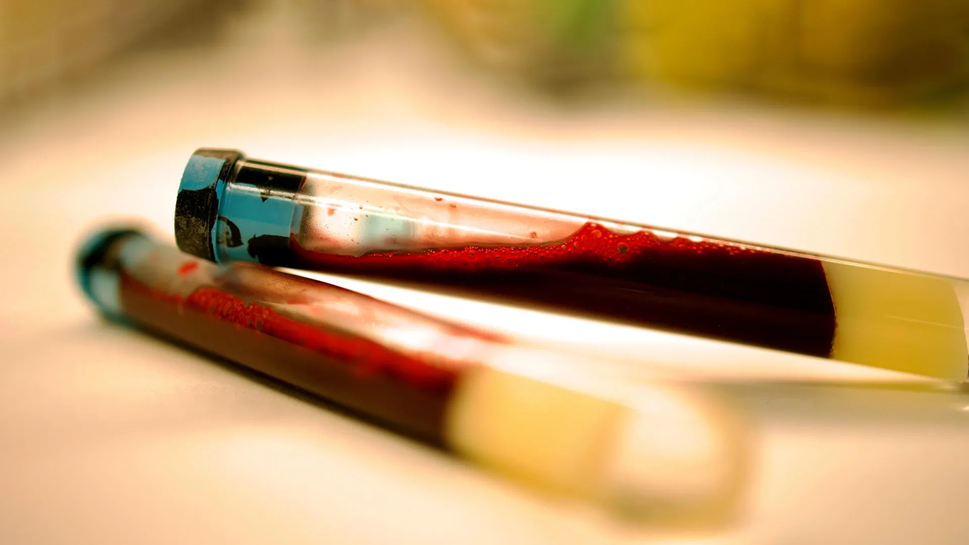 Researchers Identify Early Biological Markers for Parkinson's Disease ...