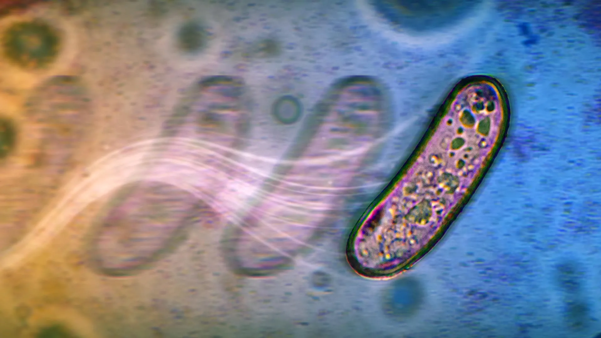 Bacteria Can Survive and Spread Without Flagella, Researchers Discover ...