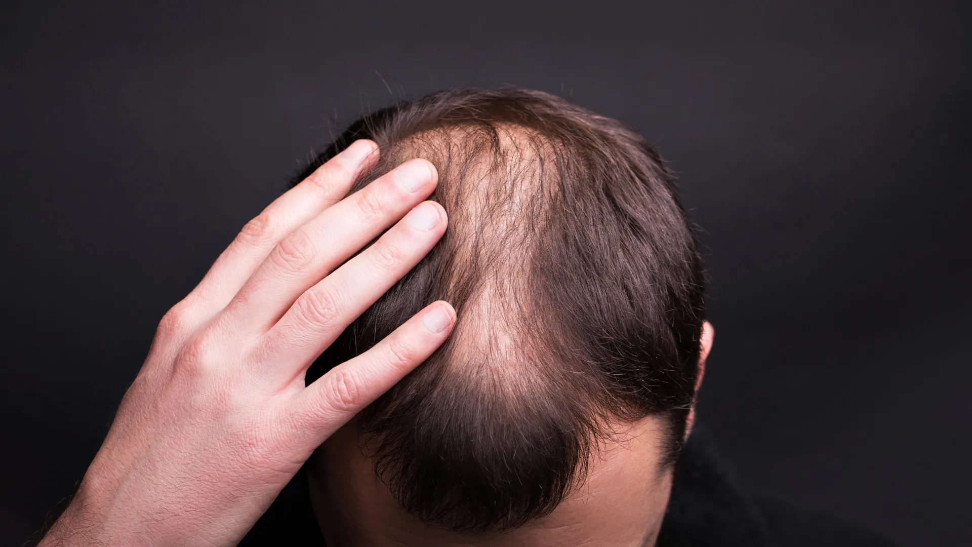 New Discovery Changes Understanding of Hair Growth Mechanics - SSBCrack ...